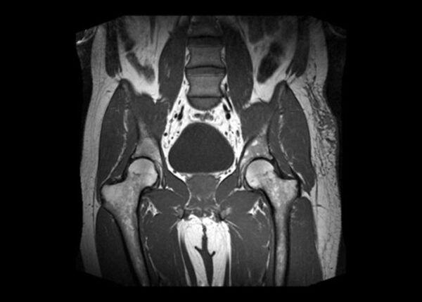 MRI scan for the pelvis - Dubai-Dr